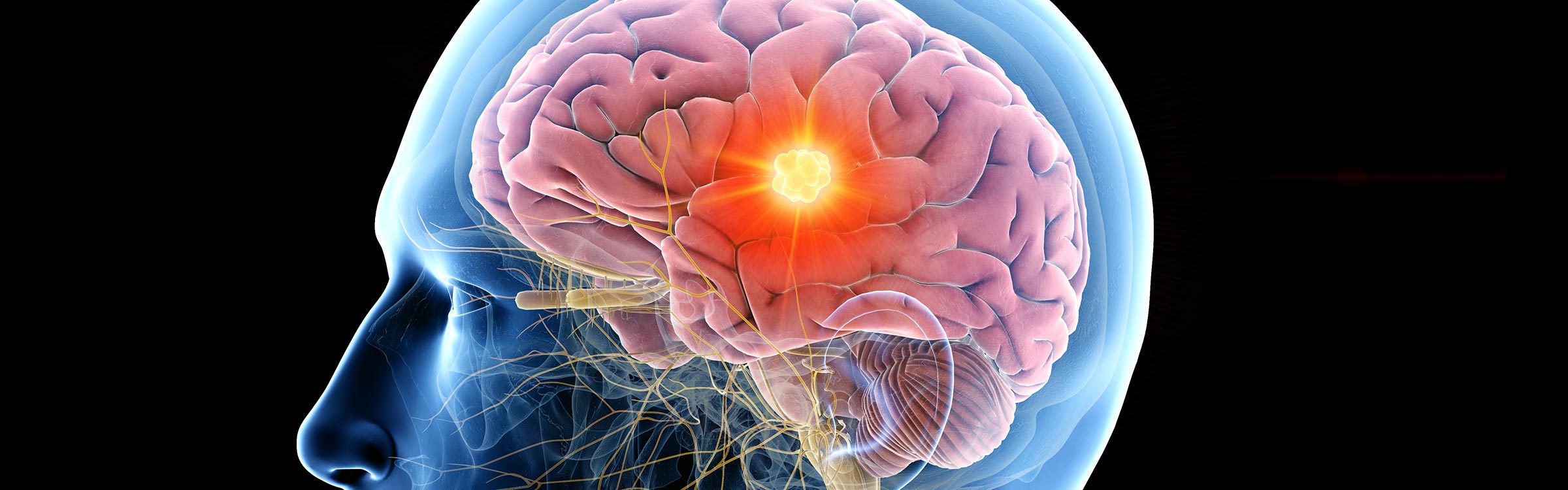 Substance Abuse & Its Effects on the Brain - Recovery Centers of America
